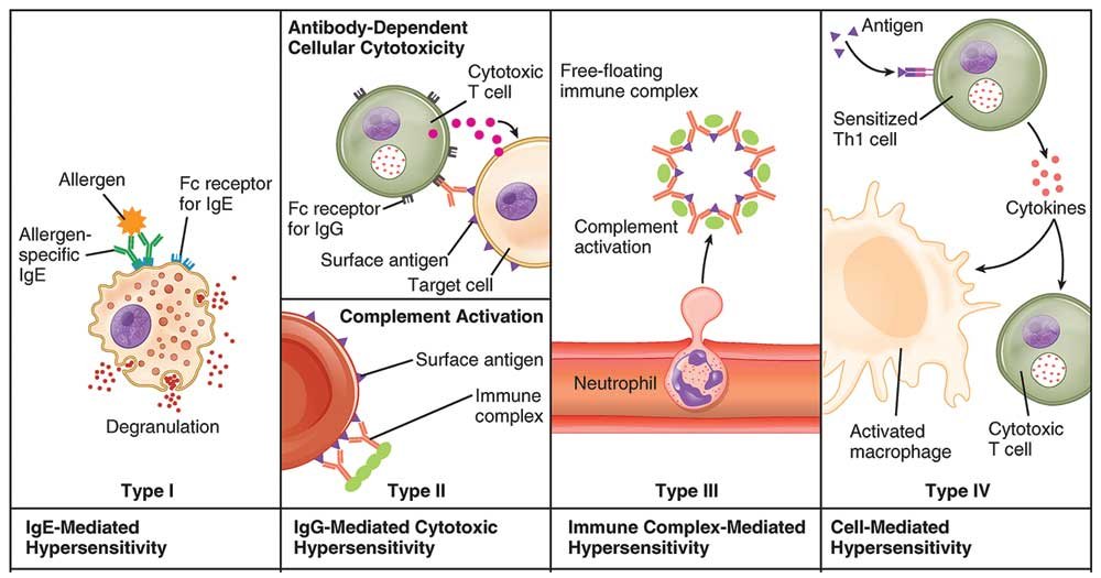 Hypersensitivity And Its Types The Science Notes Hypersensitivity And Its Types The Science Notes