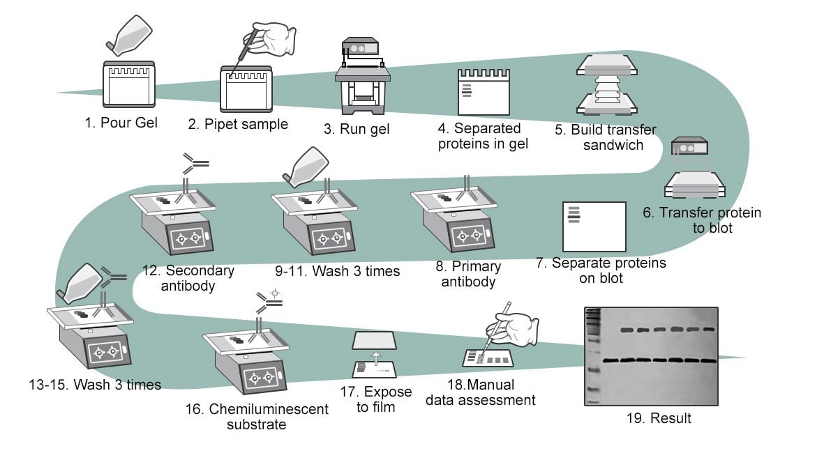 Western Blotting : Principle, Procedure and Applications