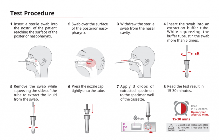 Rapid Diagnostic Tests (RDTs): Principle, Types, Procedures, and ...