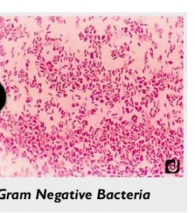 Differences between Gram-positive bacteria and Gram-negative bacteria