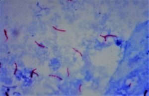 Staining Techniques: Gram staining, Acid Fast Bacilli, Spore, and ...